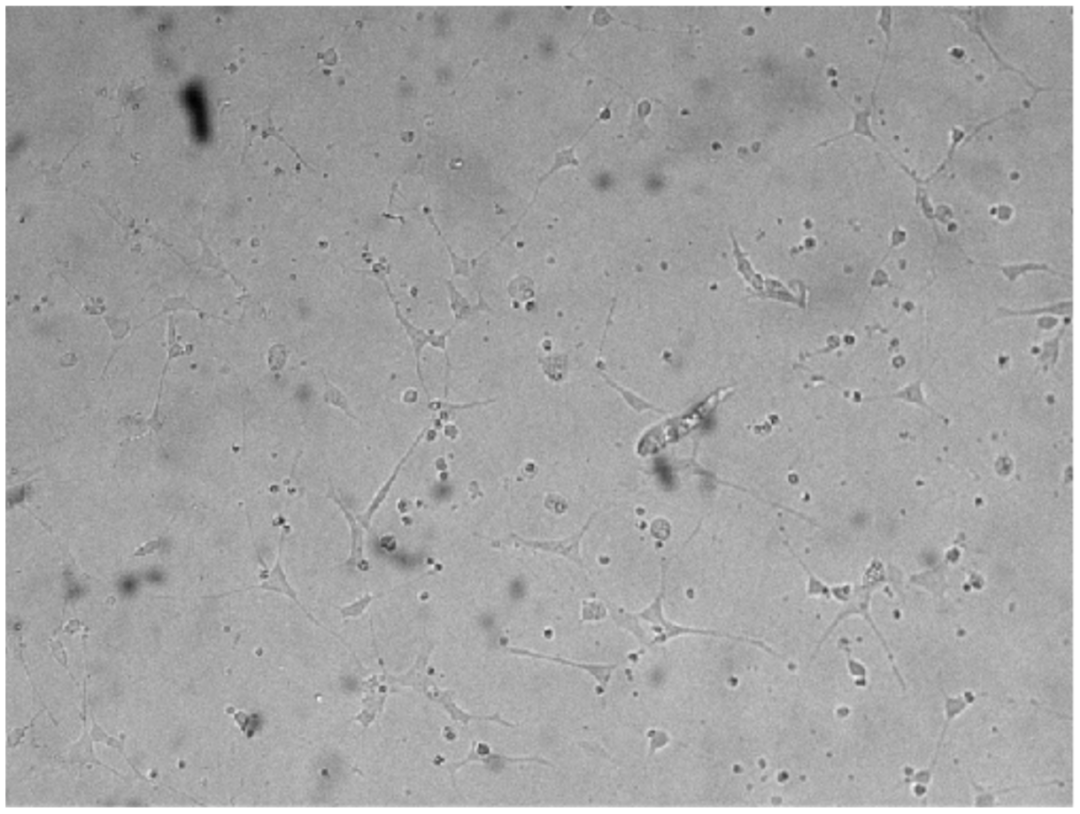 BacMam Expression System | Montana Molecular
