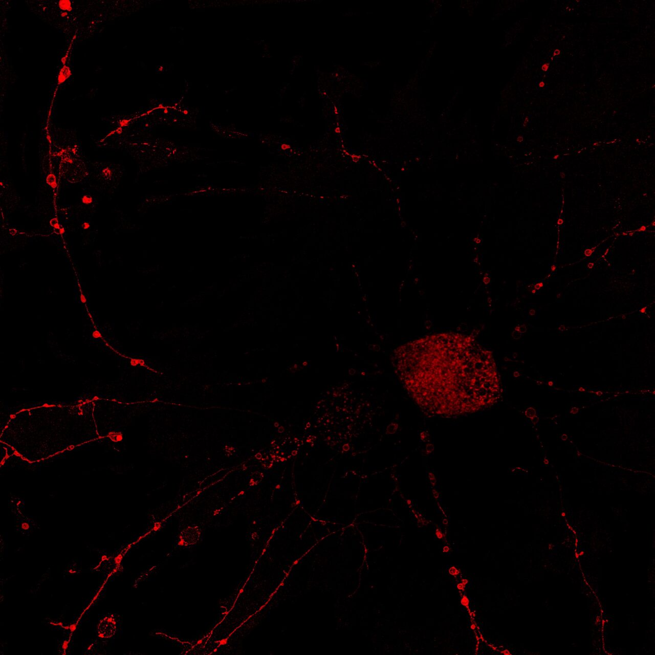 Expression in iPSC Derived Neurons | Montana Molecular