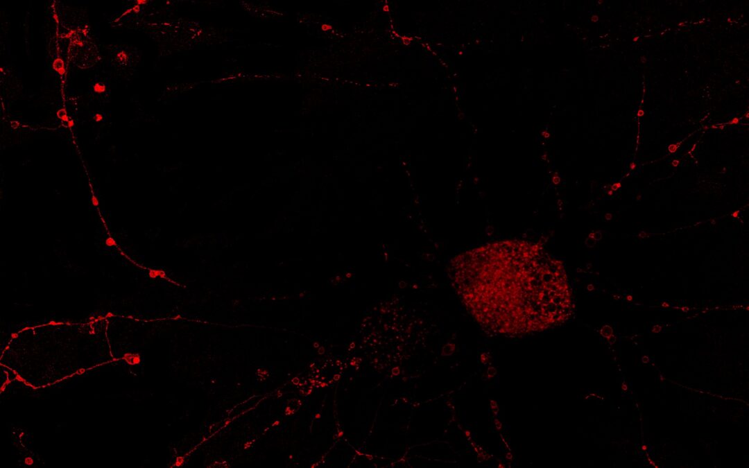 Lamp1 Red (Neuron) | Montana Molecular