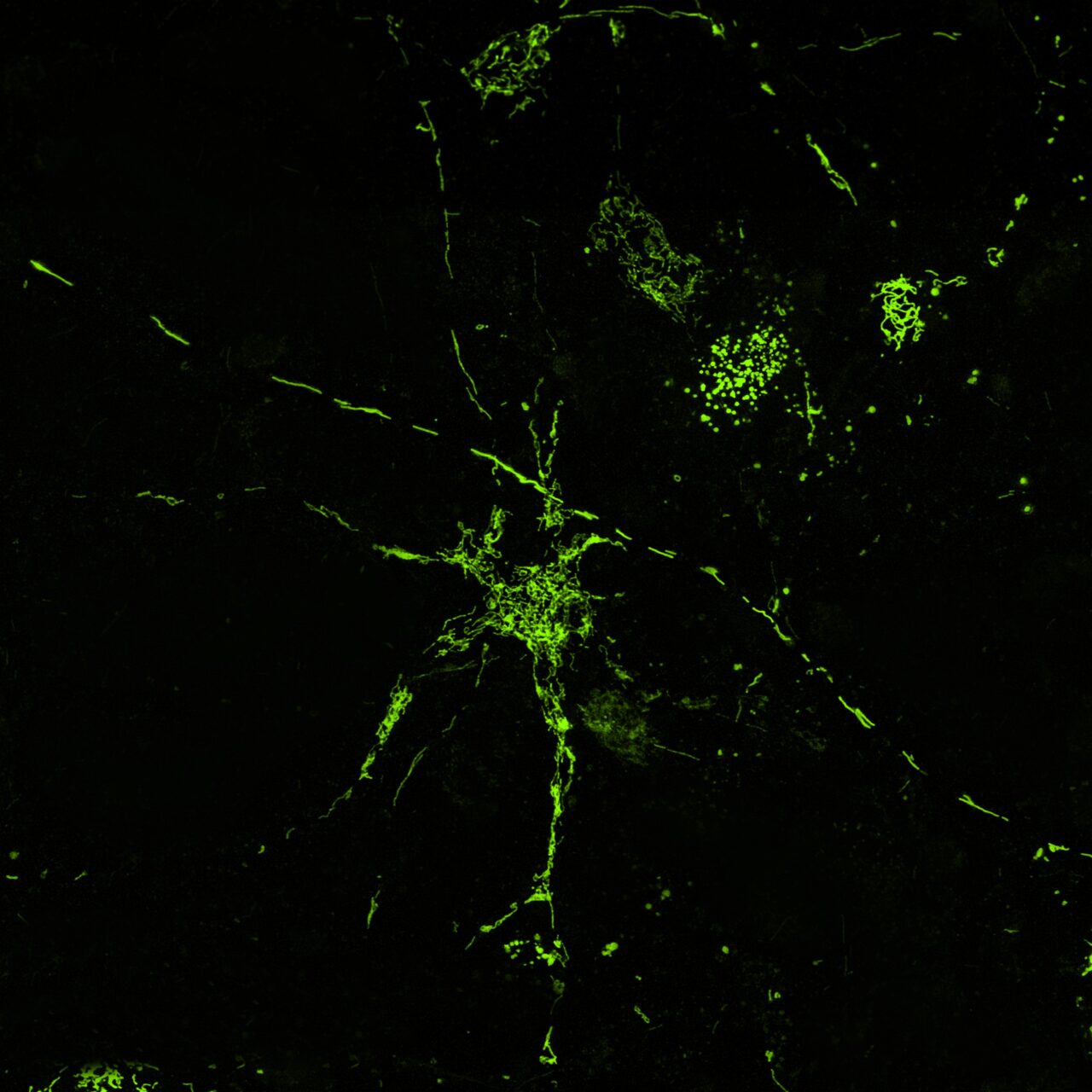 Green MitoPaint - mNeon Green Mitochondrial Label (P1010G) | Montana ...